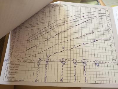 Gravidogram 36+5 - Diskuze - eMimino.cz