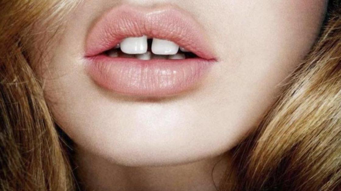 Taky máte předkus a už se vám někdo smál ? - Diskuze - eMimino.cz