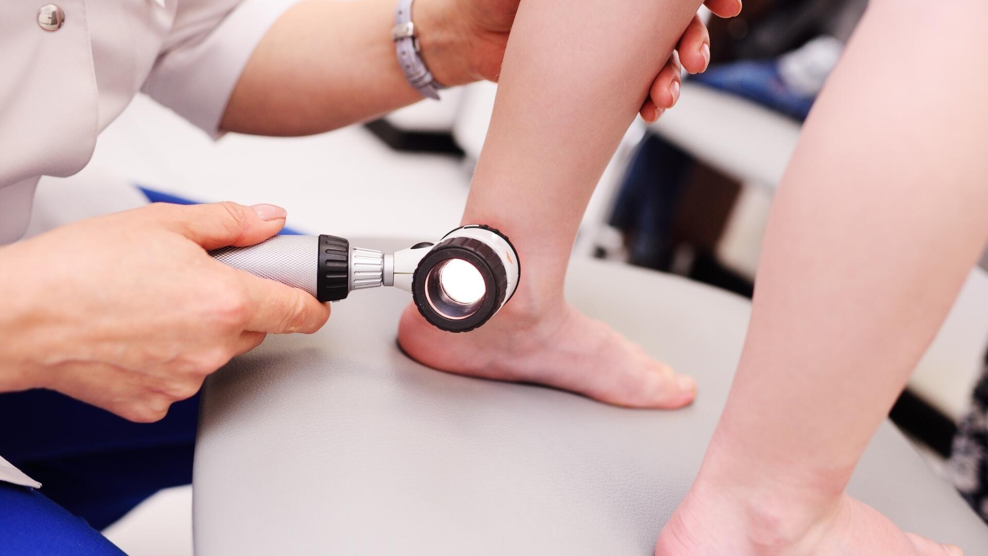 Kdy jít na vyšetření znamének - eMimino.cz